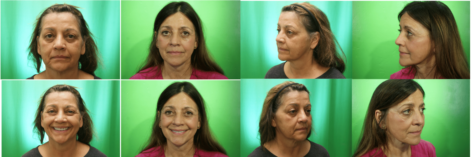 | Plastic Surgeon in Poway, San Diego CA